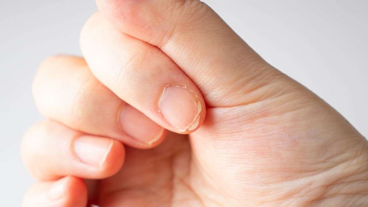 How Your Shower Water Could Be Weakening Your Nails Without You Realiz – UCHI. Malaysia